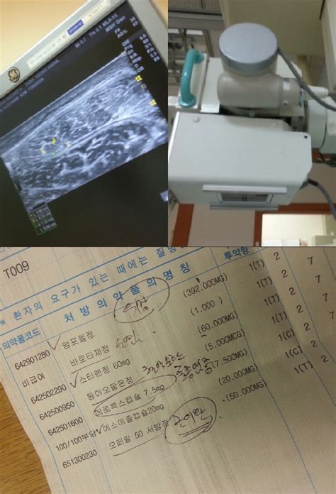 [부상치료] 종아리 비복근 근육파열 치료 D 9일차 네이버 블로그