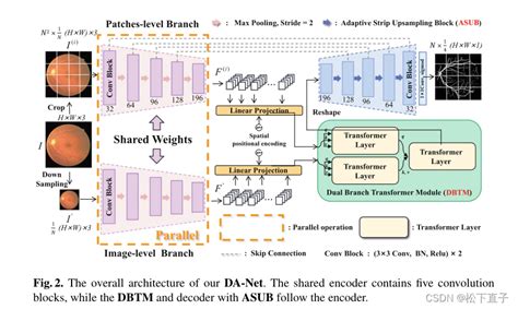 Da Net：用于视网膜血管分割的双分支transformer和自适应条带上采样dtunet Dual Branch