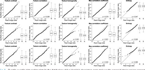 Figure 1 From Segmentation And Tracking Of Mammary Epithelial Organoids In Brightfield