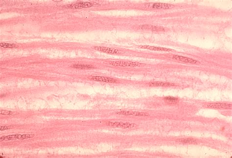 مقایسه انواع سلول های ماهیچه ای