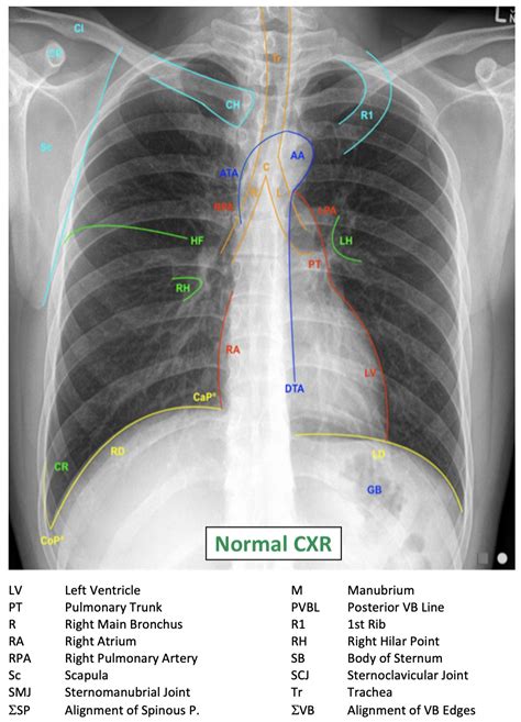 Chest Xr Interpretation Emcyclopedia