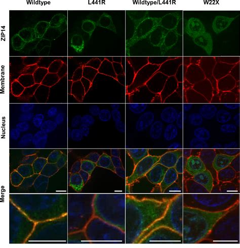 Figure 2 From Conditional Mouse Models Support The Role Of Slc39a14 Zip14 In Hyperostosis