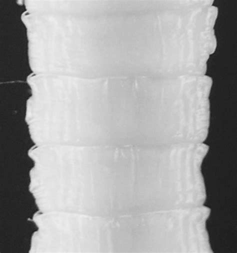 Close Up View Of The Immature Proglottids Of The Tapeworm Original Download Scientific Diagram