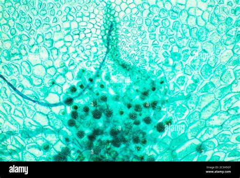 Fern Sporophyte Microscope