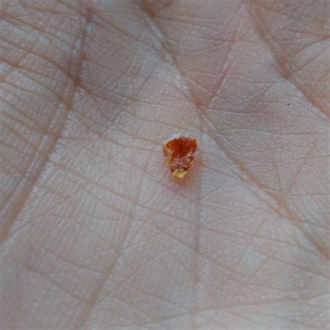 Ideas 35 Of Bed Bug Shells Rapsodettan