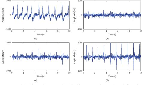 Figure 1 From Eeg Signals Analysis Using Multiscale Entropy For Depth Of Anesthesia Monitoring