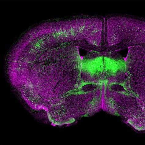 Primary Neuronal Culture Transfection Reagents Researchgate