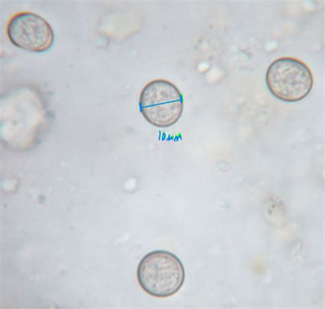 Phylum Apicomplexa Lecture 40 Flashcards Quizlet