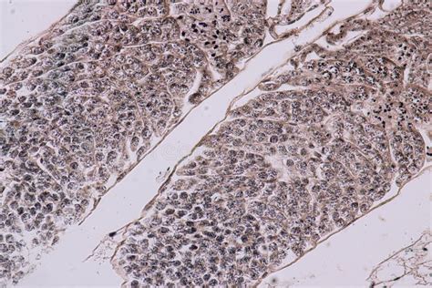 Grasshopper Testis Under The Microscope In Lab Stock Image Image Of