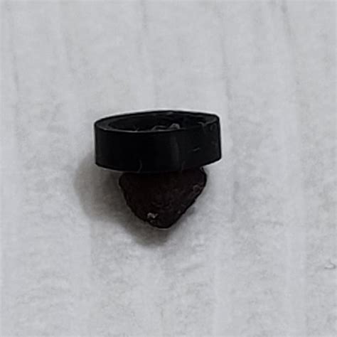 Update 2 Oclock Hemorrhoid In Band Fell Off Yesterday 4624 Around 5