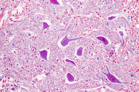 Spinal Cord Nerve Cerebellum Cortex And Motor Neuron Human Under The Microscope Stock Image
