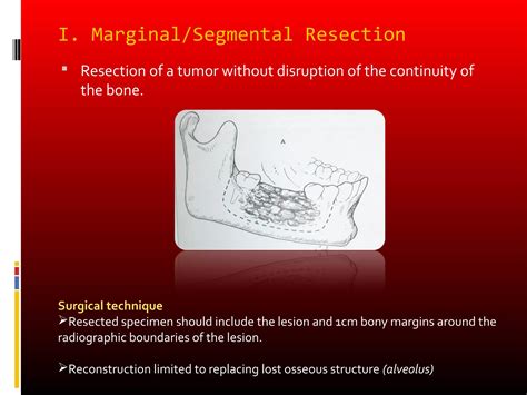 Resection Oral Surgery Very Simplified Ppt