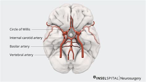 Cerebral Vessels Subacute Middle Cerebral Artery Revascularization