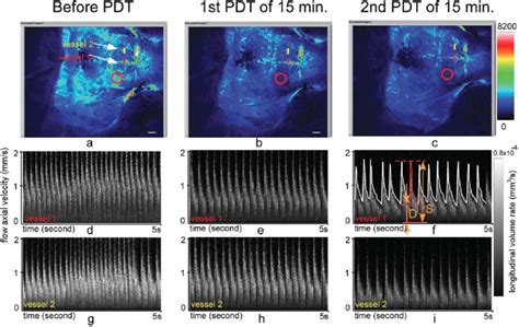 Laser Speckle Imaging And Phase Resolved Doppler Oct Measurements Download Scientific Diagram