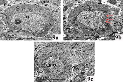 Transmission Electron Micrographs Of Cerebellar Cortex Of Pnd10 Download Scientific Diagram
