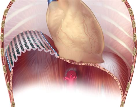 Diaphragm Function And Structure At Lisa Cunningham Blog