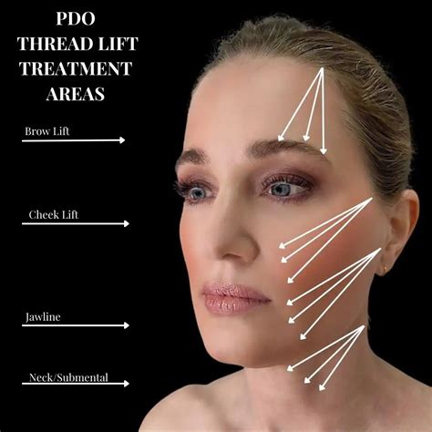 Pdo Threads Spectrum Dermatology Of Seattle