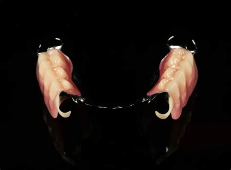 Partial Dentures With Metal Clasps Golden Smile Dental Lab