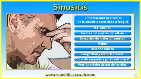 Sinusitis Doctor Condezo