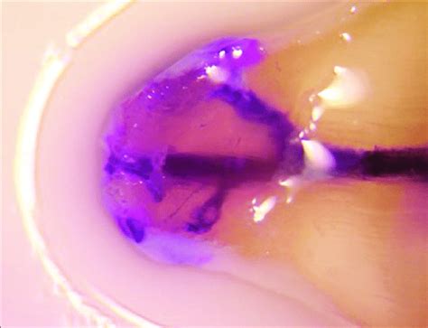 First Lower Premolar Root Apex The Complexity Of The Endodontic Space Download Scientific