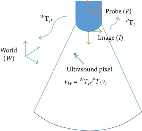 Principle Of Freehand 3d Ultrasound Each Ultrasound Pixel Of An Download Scientific Diagram