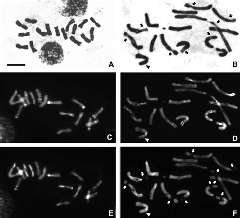 Conventional Staining And Cma Dapi Banding In Cestrum Strigilatum Download Scientific Diagram