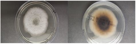 Phaeohyphomycosis In Solid Organ Transplant Recipients A Case Series And Narrative Review Of