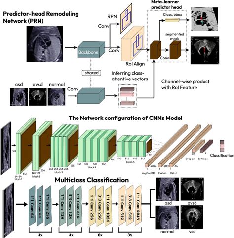 A Stacked Residual Dense Network Model Based On Two Modalities