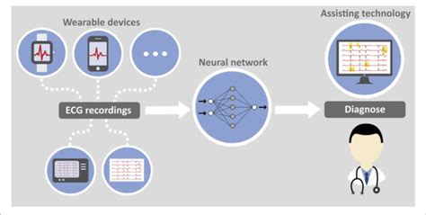 Computer Aided Ecg Analysis With Doctor And Assisting Technology Download Scientific Diagram
