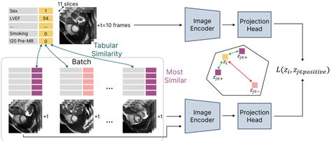 논문 리뷰 Tgv Tabular Data Guided Learning Of Visual Cardiac Representations