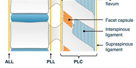 Cervical Spine Hyperflexion Injuries By Alexander Baxter