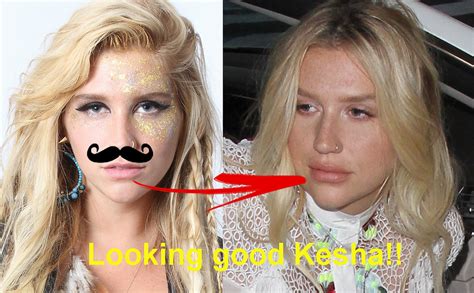 Kesha Jumps On The Bandwagon And Plumps Her Lips