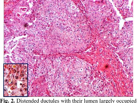 Ceruminous Glands Histology
