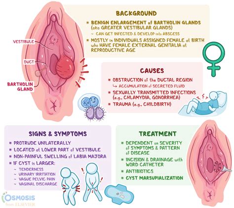 Bartholin Cyst What Is It Causes Signs And Symptoms And More Osmosis
