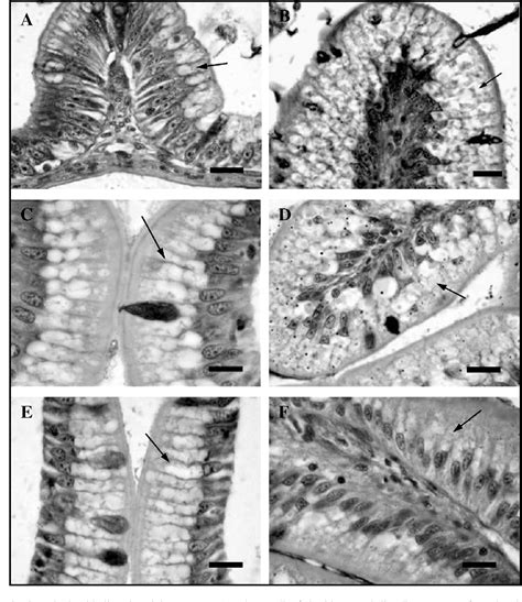 Silvermeal Heuristic Semantic Scholar