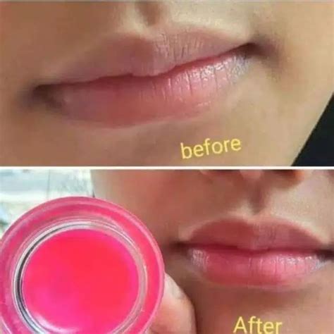 Jual Lip Care Sr12 Shopee Indonesia