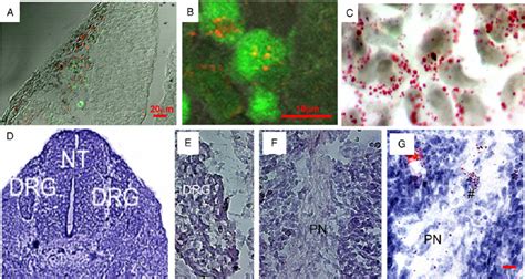 Migrating Neural Crest Cells Show Lipid Accumulation A C Download Scientific Diagram