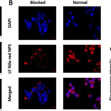 Characterization Of Nanoparticles A Tem Analysis Of Nanoparticles
