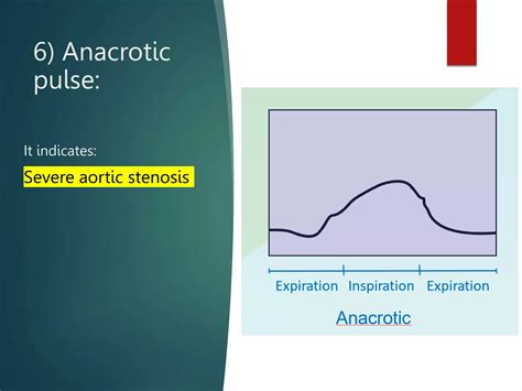 Heart Sounds And Pulse Abnormalities Physiology Y2b2 Pptx