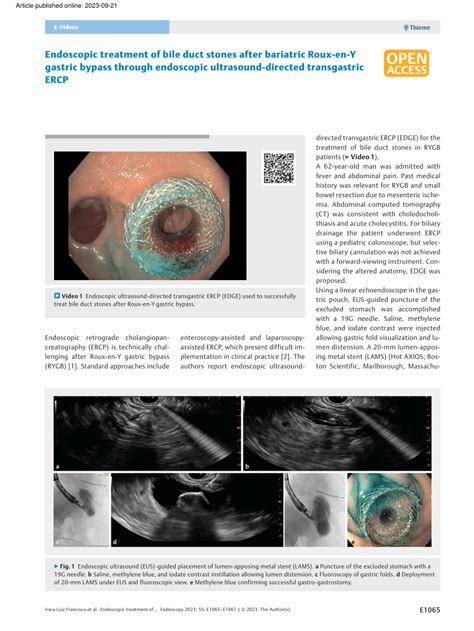 Pdf Endoscopic Treatment Of Bile Duct Stones After Bariatric Roux En Y Gastric Bypass Through