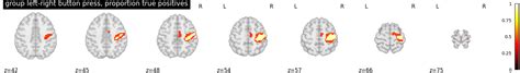 Nilearn Statistical Analysis For Neuroimaging In Python — Machine