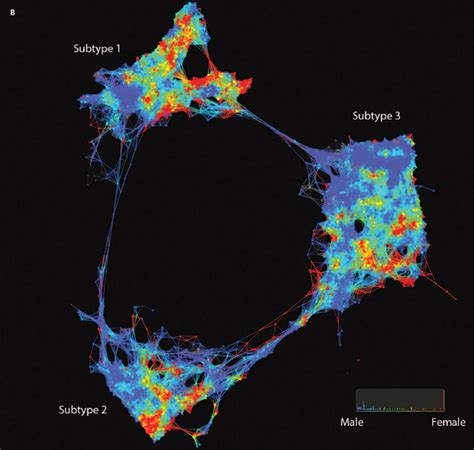 identification of type 2 diabetes subgroups through topological data analysis of patient