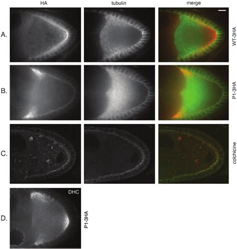 Novel Localization Of Mutant P Loop Dyneins Appears To Represent