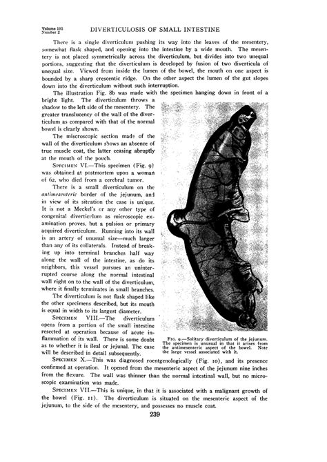 DIVERTICULOSIS OF THE SMALL INTESTINE PMC