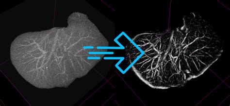 3d slicer s liver segmentation a look at the new features