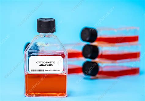 Cytogenetic Analysis Stock Image F044 6873 Science Photo Library