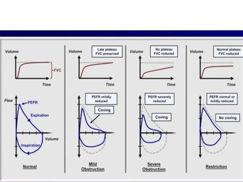 Pulmonary Function Tests