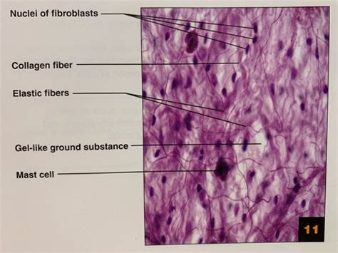 Reticular Loose Connective Tissue