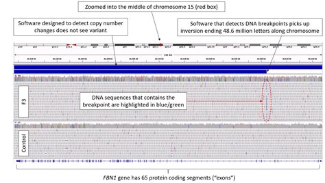 An Open Book New Genetic Mutation Linked To Rare Conditions Nihr Oxford Biomedical Research