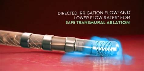 雅培独家！消融导管获批ce上市 知乎